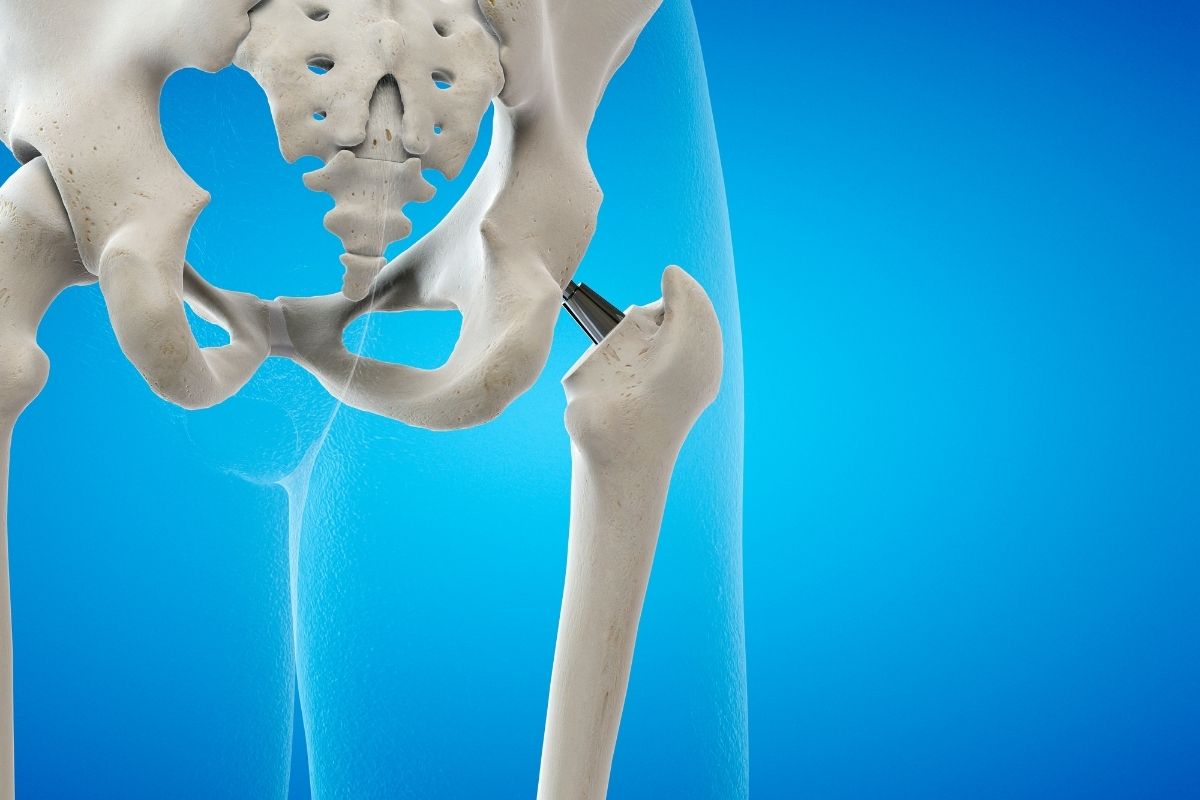 Stryker Wins FDA Nod for Total Ankle System - SYK Stock